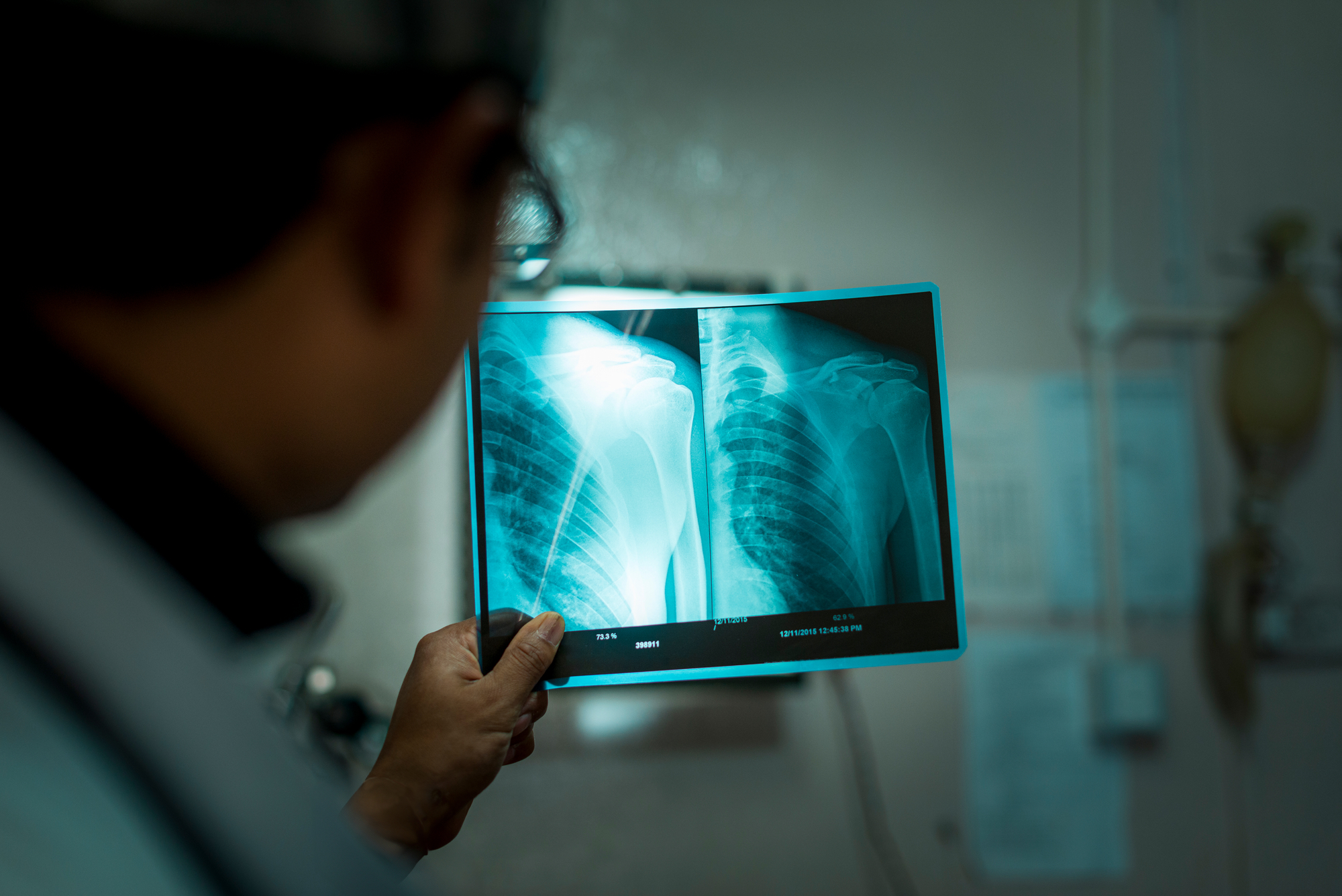 Distal bicep tendon repair