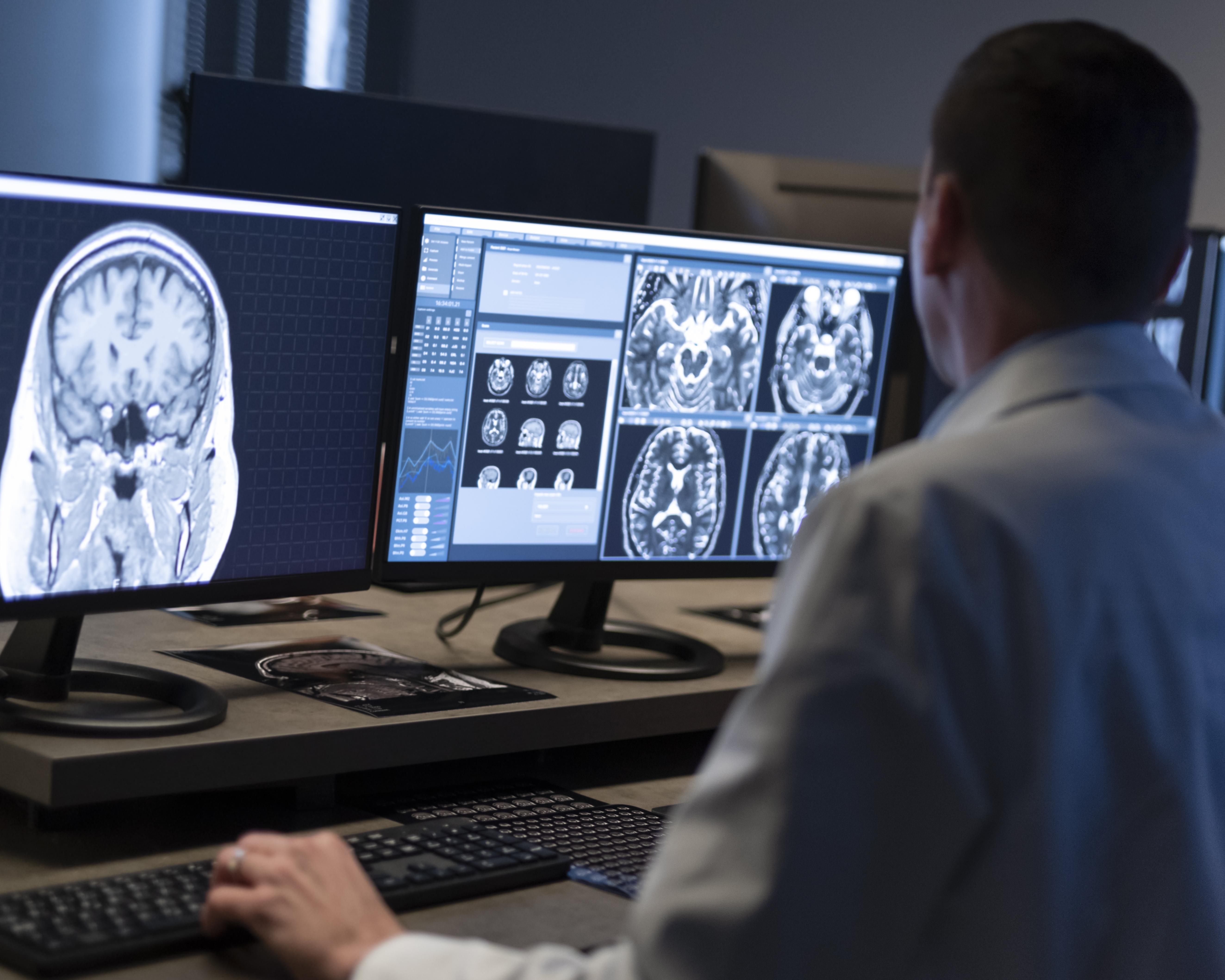 Intraoperative Magnetic Resonance Imaging (iMRI)