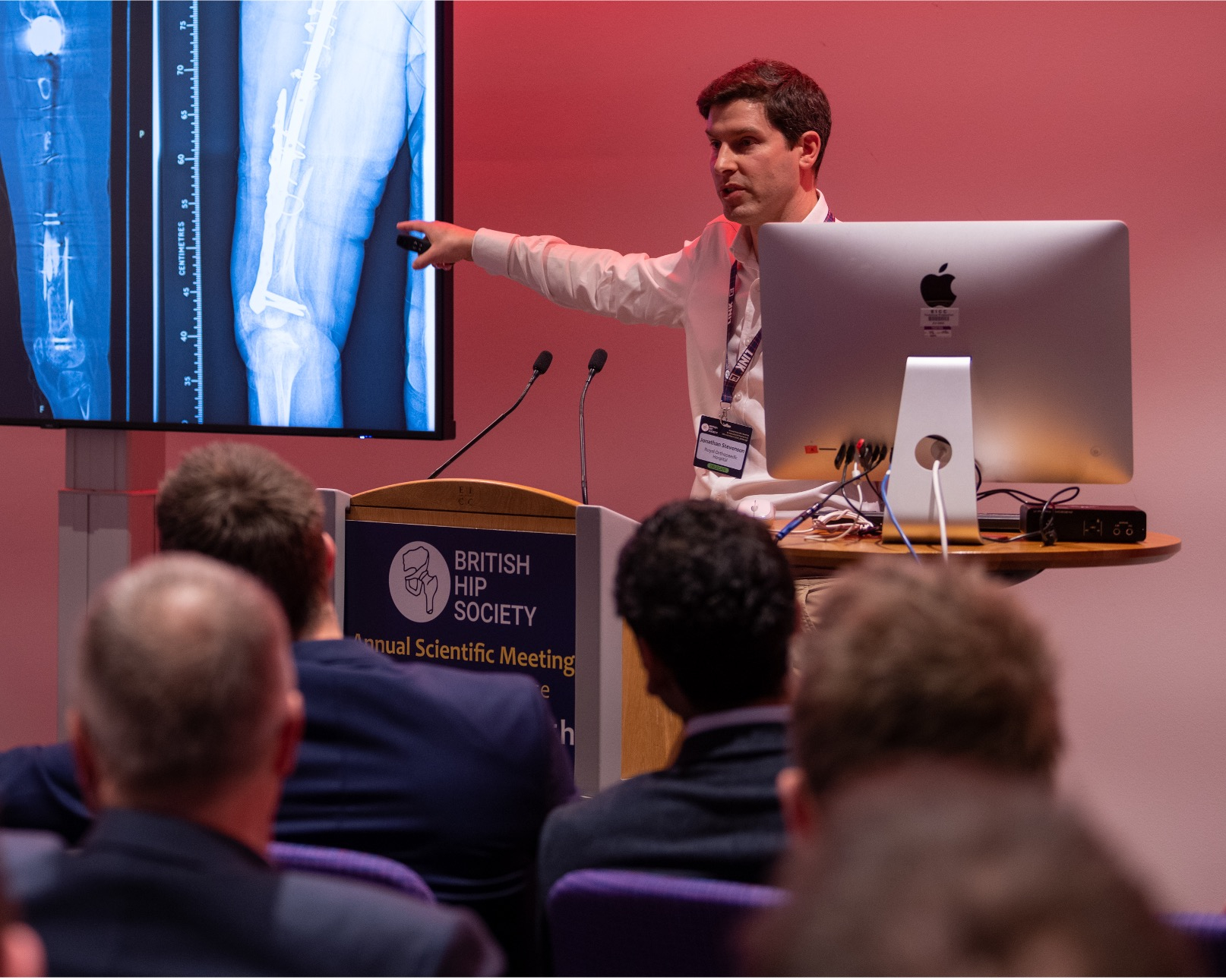 The future of metastatic bone cancer surgery: the innovations that are ...