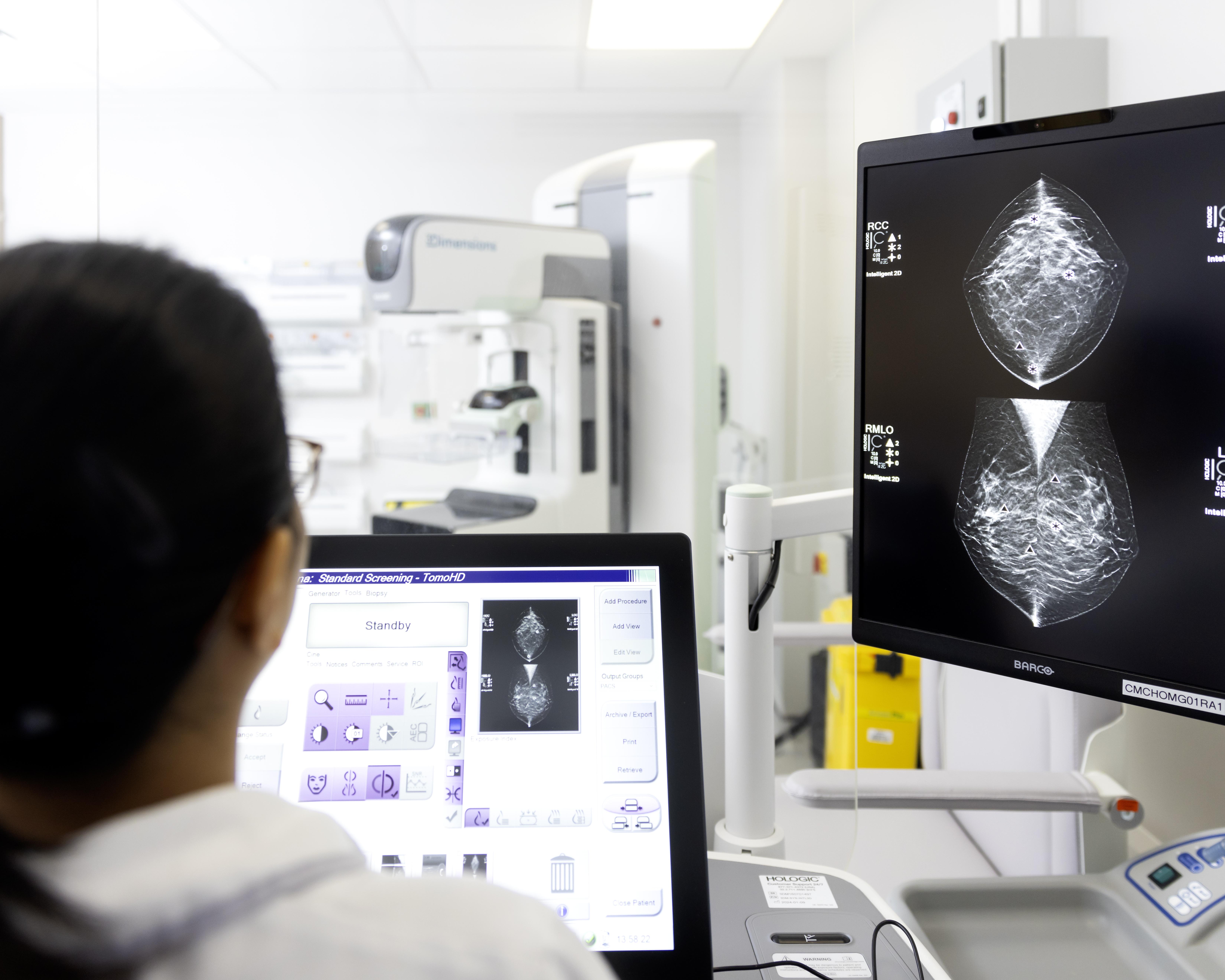 Private Tomosynthesis Screening For Breast Cancer